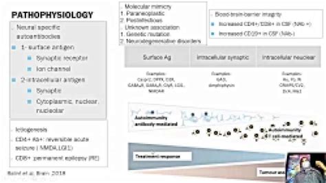 Management Of Autoimmune Epilepsy Dr S Haghighi