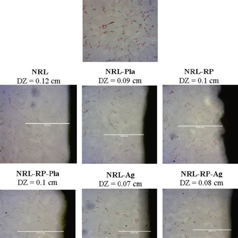 Overlay Assay With L929 Cells Visualization On Inverted Microscope