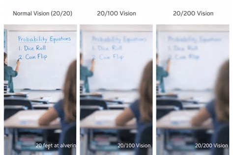 What Does 20 100 Vision Look Like Dr Denise M Robinson