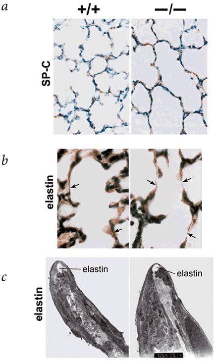 Cell Differentiation And Elastin Deposition In The Lungs Of Mice
