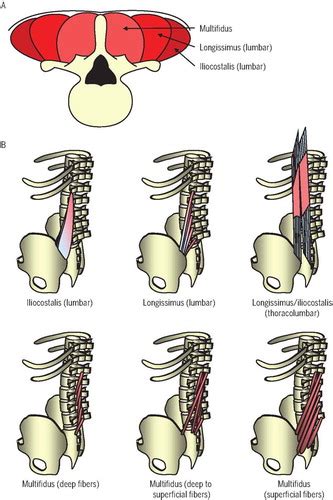 Multifidus And Erector Spinae