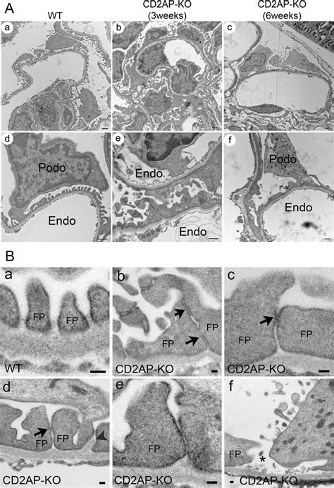 Podocyte Morphology In Wt And Cd2ap Deficient Mice By Tem A Download Scientific Diagram