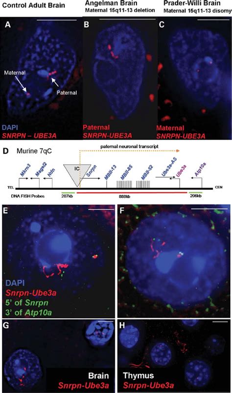 Dna Fish Using A Probe Contig Spanning Snrpn Ube3a Red Fluorescence
