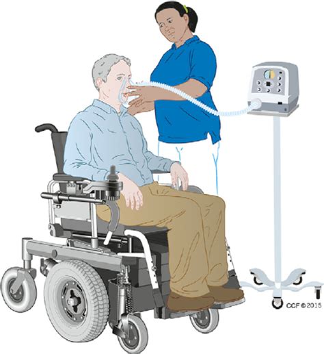This Illustration Shows Proper Hand Placement For A Manually Assisted