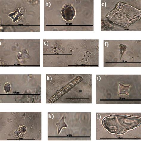 Following Icpn 20 A Rondel Morphotype D18 10 20 Cm B Spheroid