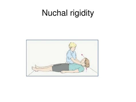 Ppt Acute Cns Infections Meningitis Overview Powerpoint Presentation Id9360986