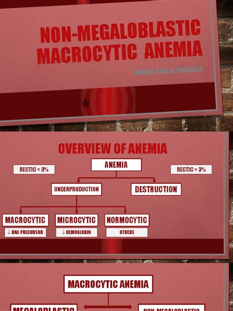 Non Megaloblastic Macrocytic Anemia Carmel Anne G Brasales Pdf Anemia Anatomy