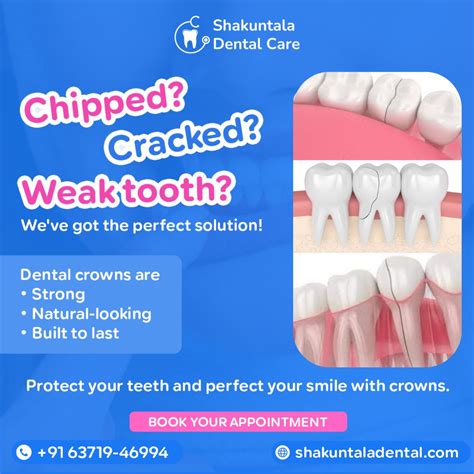 Dr Subhashree Pradhan On Linkedin Chippedtoperfect Dentalcrowns
