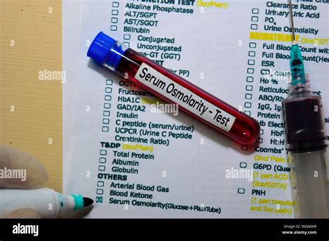 Serum Osmolarity Test With Blood Sample Top View Isolated On Office