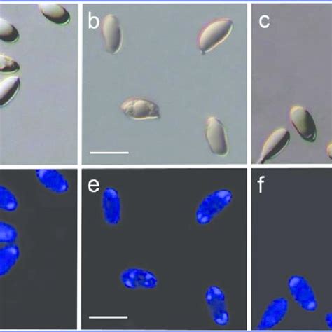 Differential Interference Contrast Microscopy Ac And Dapi