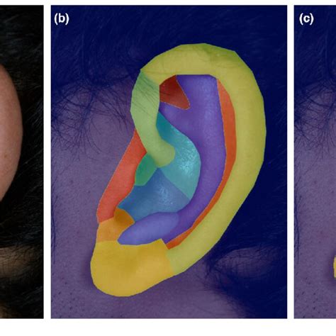 Ear Test Sample A With Experts Annotations B And Dlms Predictions