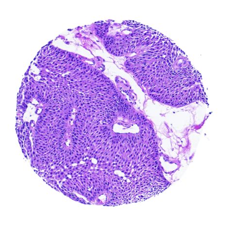 Tissue Microarray Human Tissue Microarray Mymab Biologics