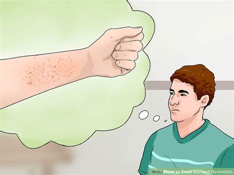 How To Treat Contact Dermatitis 15 Steps With Pictures