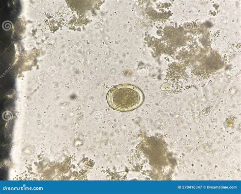 Ascaris Lumbricoides Egg Human Parasite Stock Image