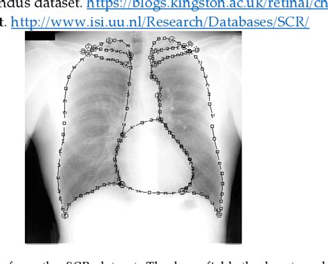 Pdf U Net And Its Variants For Medical Image Segmentation A Review
