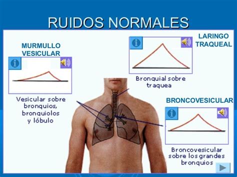 Murmullo Vesicular Qué Es Características Disminuido Y Aumentado Wdxmu