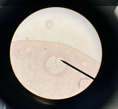 Ap2 Final Practical Microscope Slides Flashcards Quizlet