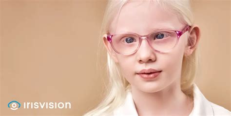 Ocular Albinism Educational Implications Inspirational Education