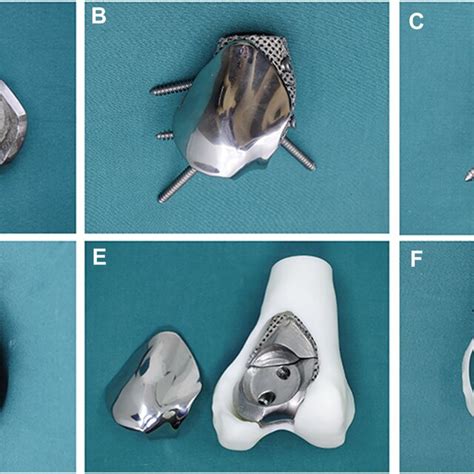 A The Back Components Left Combine With The Front Component Right Download Scientific