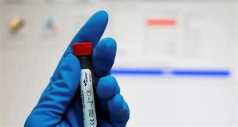 Npfl To Begin Random Doping Tests For Players Thecable