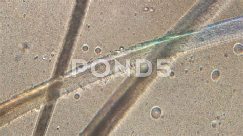 Human Hair Root Microscope
