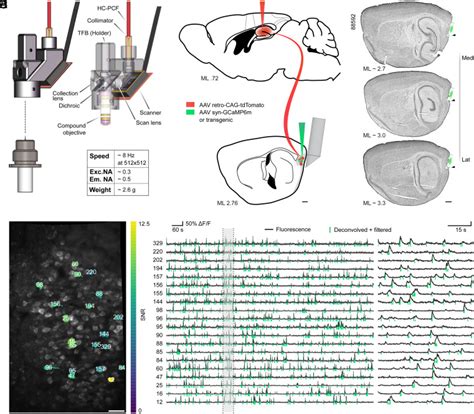 Functional Network Topography Of The Medial Entorhinal Cortex Pmc
