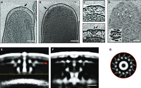 In Situ Structure Of The C Burnetii T4ss A And B Slices Through