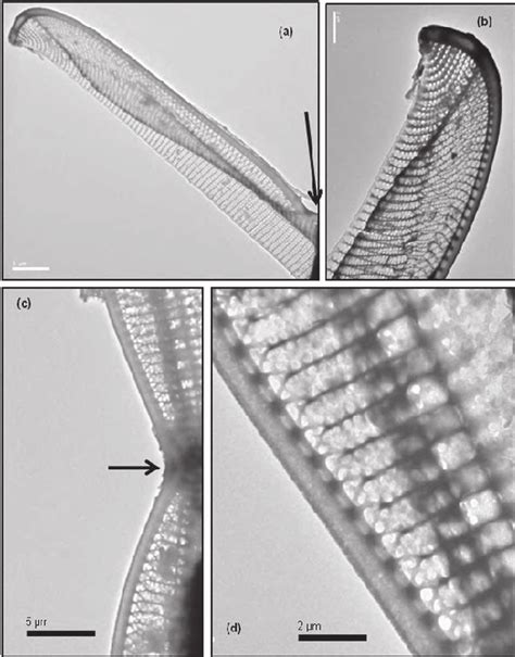 Micrographs Of Amphiprora Species A B A Gigantea Observed Under