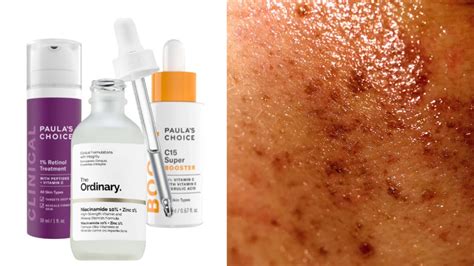 The Best Skincare For Hyperpigmentation Youtube