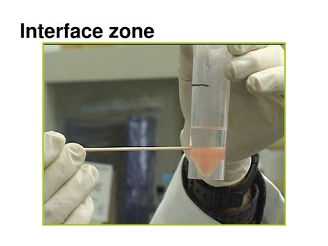Ppt Dna Extraction Strawberries Powerpoint Presentation Free