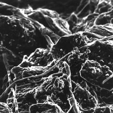 Binding Of Soil Particles By Fungal Hyphae Reprinted With Permission