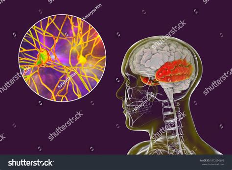 Human Brain Highlighted Temporal Lobe Closeup Stock Illustration 1872650686