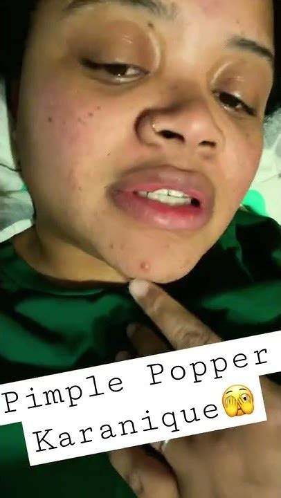 Major Pimple Pop Youtubeshorts Shouldi 🤔🤭🤣 Shorts Youtube