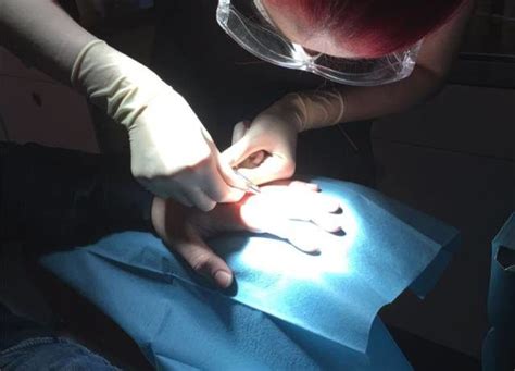 From Magnets To Sex Toys Biohackers Are Implanting Everything