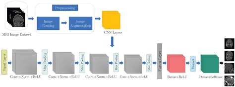 Electronics Free Full Text Classifying Brain Tumors On Magnetic Resonance Imaging By Using