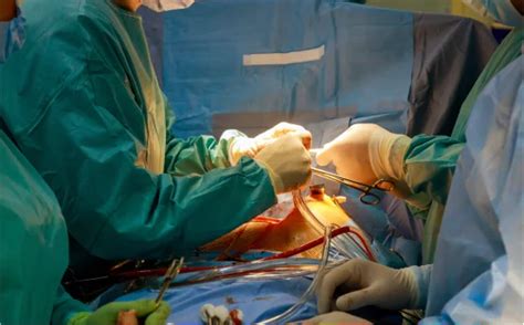 Causes For Thoracotomy Surgery Medisuggest