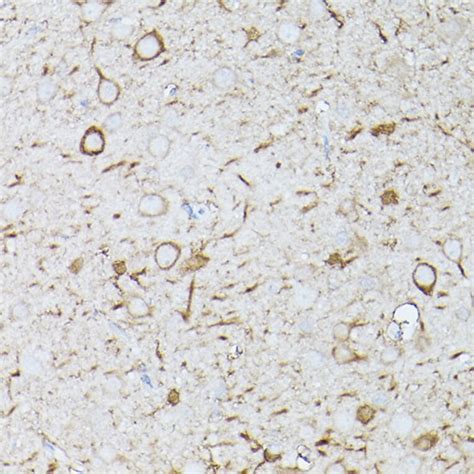 Anti Interferon Alpha Beta Receptor 1 Antibody A308248