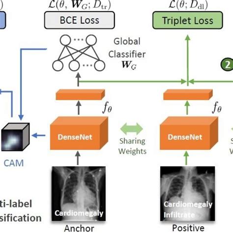 a distance learning based model for thoracic pathology classification