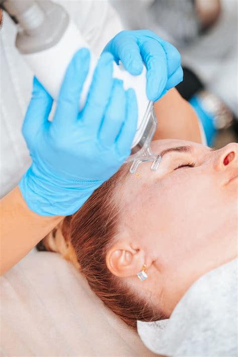 Laser Removal Of Scars And Scars On The Skin Stock Image Image Of