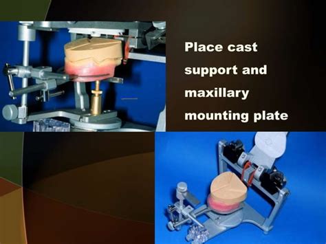 4 C Face Bow Record Ppt Dental Health Diseases And Conditions
