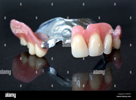False Teeth Dentures With At Isabel Cremean Blog
