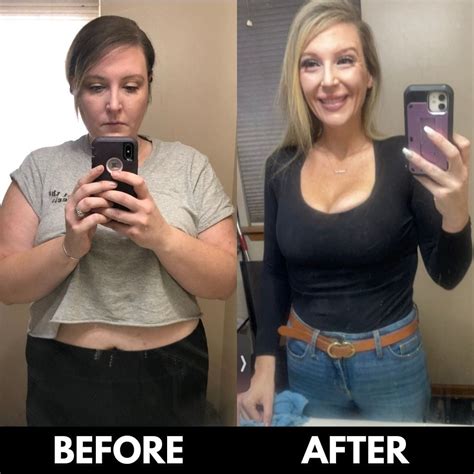 Glp 1 Gip Agonist Weight Management