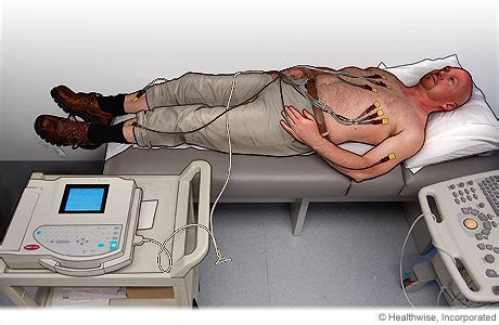 Electrocardiogram And Electrode Placement Healthlink Bc