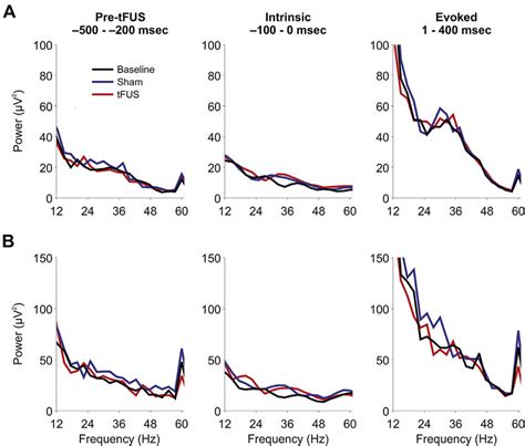 Power Spectra Of Eeg Data Average Power Spectra Recorded From