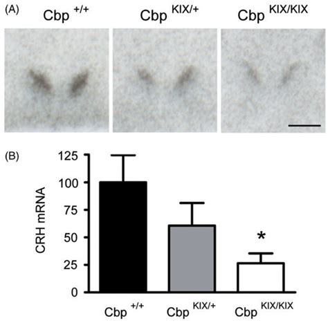 In 9 Day Old Mice Impaired Functional Interaction Between Cbp And Creb