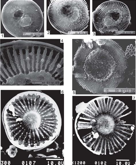 Stages Of Sequential Dissolution Of Cyclotella Sp C 14 V Katina