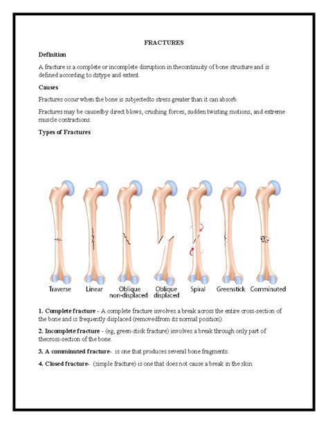 Fracture Management Fractures Definition A Fracture Is A Complete Or