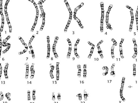 染色体变异类型总结，数目、结构异常有所不同 柚鼠知识