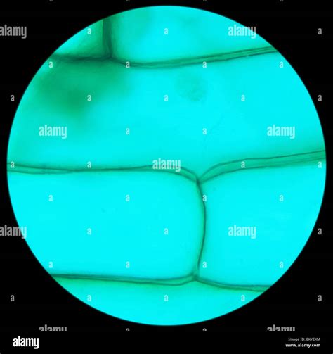 Protozoa Under Microscope 40x