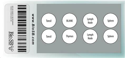 7 Core Normal Human Lymphoid Tissue Microarray Bio Sb Inc Online Store